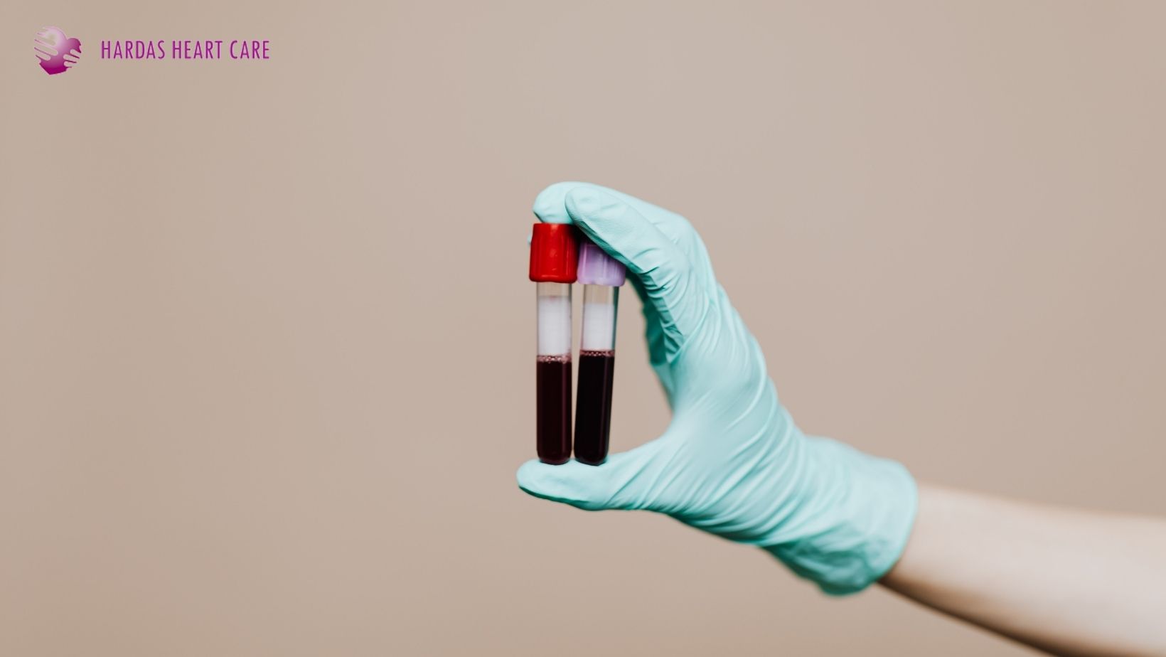 Beyond Cholesterol: The Role of CRP in Heart Risk Detection
